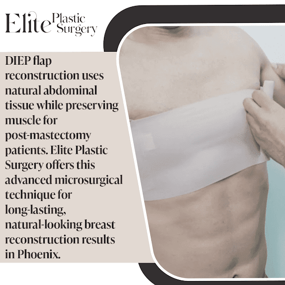 Why Turn to DIEP Flap for Natural Post-Mastectomy Reconstruction ...