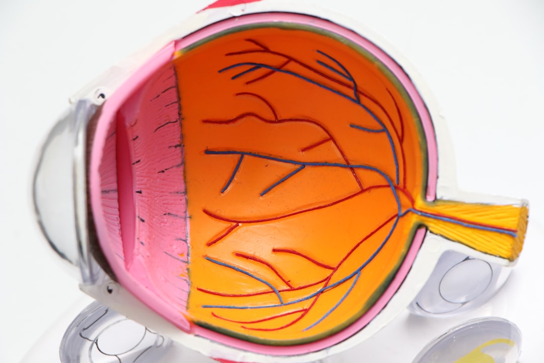 Iris Clip Lens Positioning Explained: Safety, Stability and Visual ...